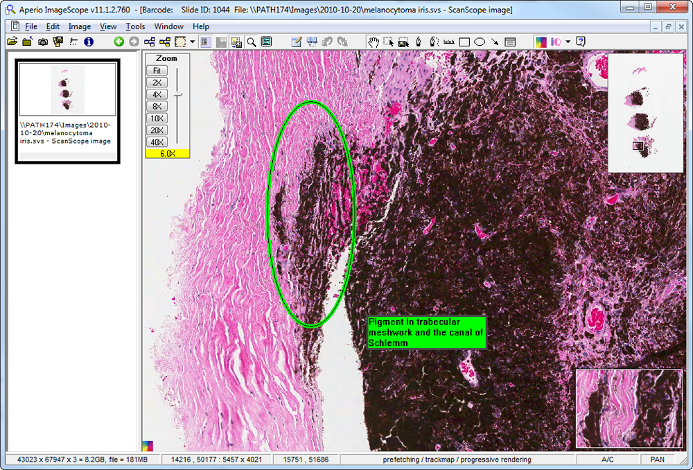 Add A Slider For Magnification Of Whole Slide Images In The Histomicstk Front End · Issue 253